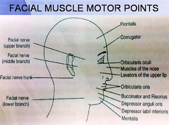 Electrical Muscle Stimulation Adalah