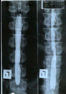 Myodil Killer: 2. Pictures and Diagrams