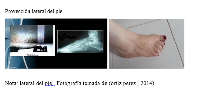 CREACION DE PROTOCOLOS : ESTUDIOS RADIOGRAFICOS MIEMBROS INFERIORES