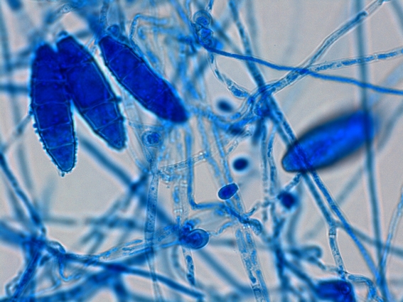 Fun With Microbiology (What's Buggin' You?): Microsporum gypseum