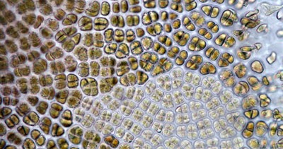 Seaweed Research Journal 海藻研究ジャーナル : Pyropia tenera（アサクサノリの果胞子嚢と造精器）