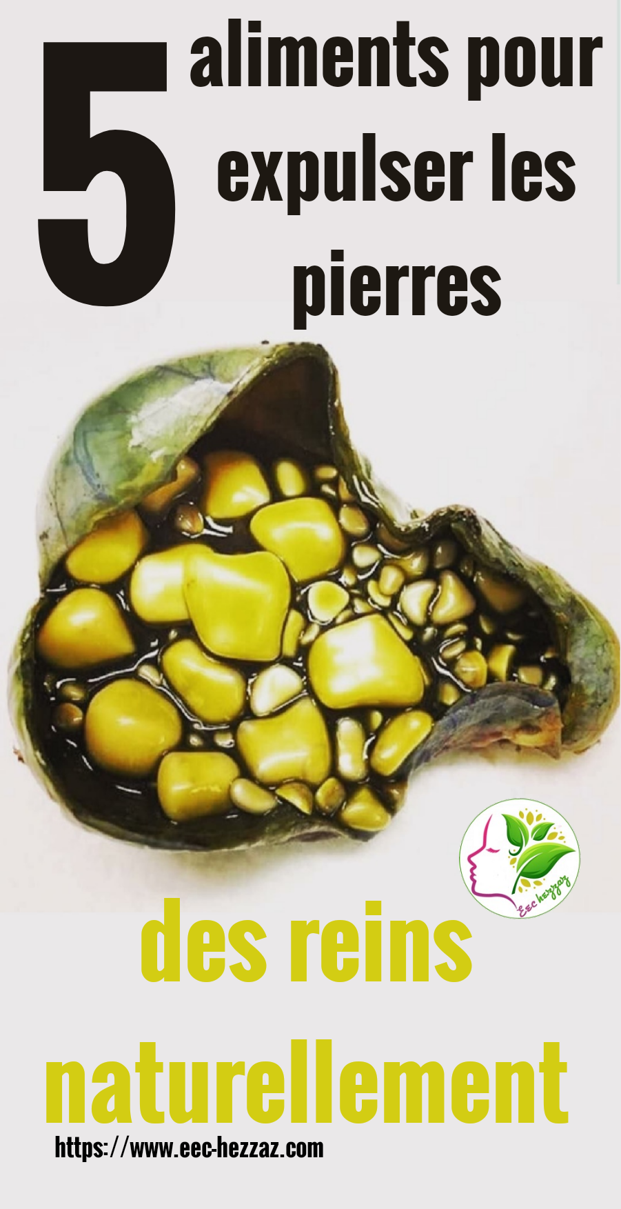 5 aliments pour expulser les pierres des reins naturellement