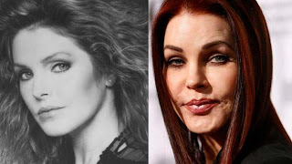 LO NUEVO DE LA RED: Las mujeres más operadas de Hollywood (+Fotos)