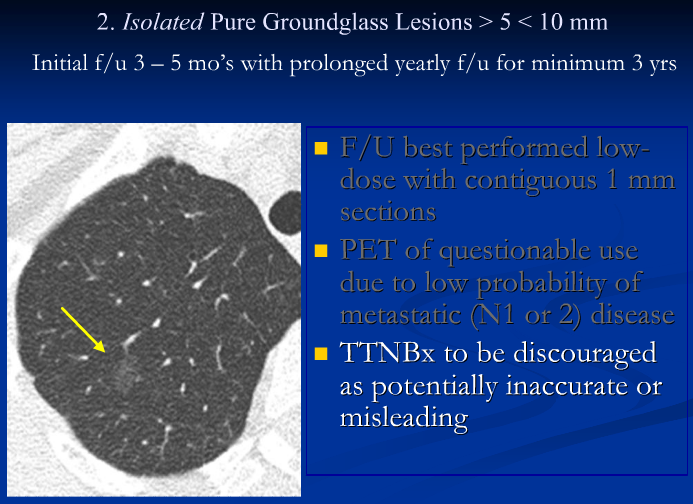 rsna: GGO lung nodule guideline