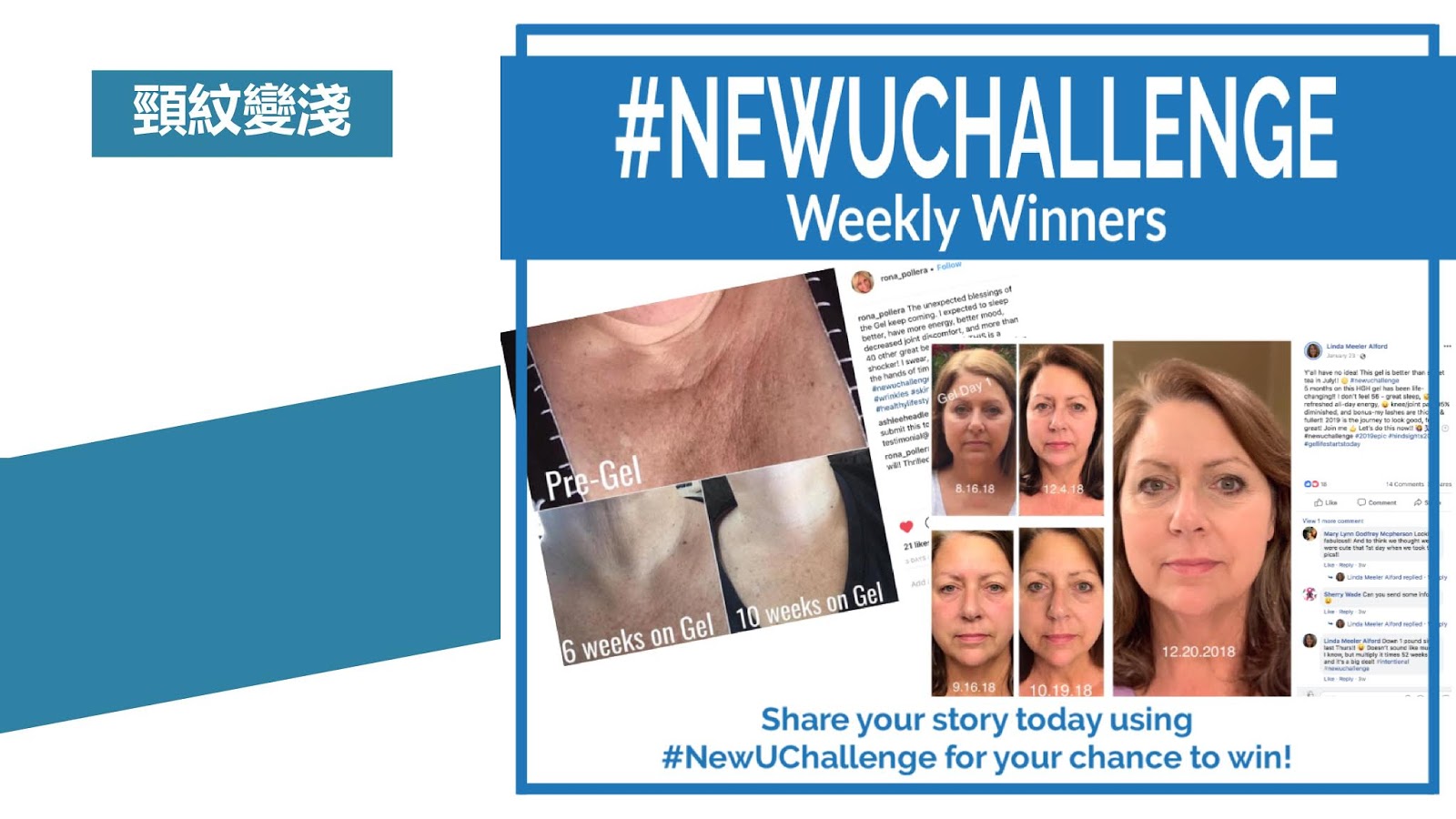 Somaderm HGH Gel - HK