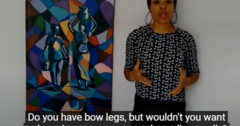 What Causes Bow Legs and Solution?