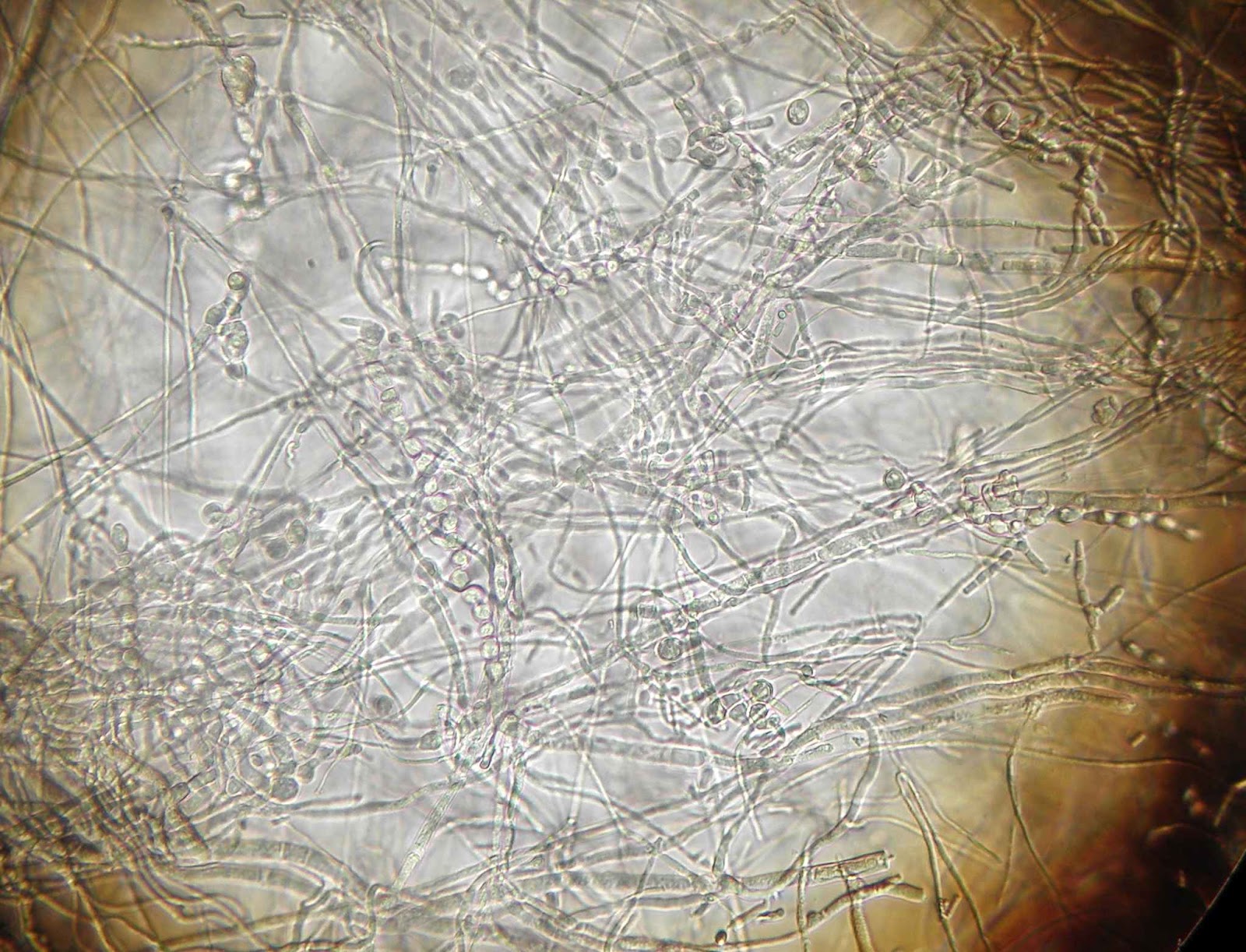 ATLAS MICOLOGIA: SCYTALIDIUM DIMIDIATUM (Neoscytalidium dimidiatum)