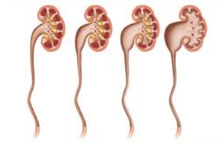 Beijing Kidney Health Care: The symptoms of renal failure patients with ...
