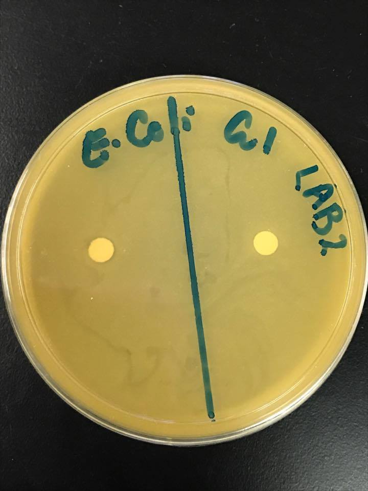 IBG 102 Lab Report Group 1: Lab 5: Determination of antimicrobial ...