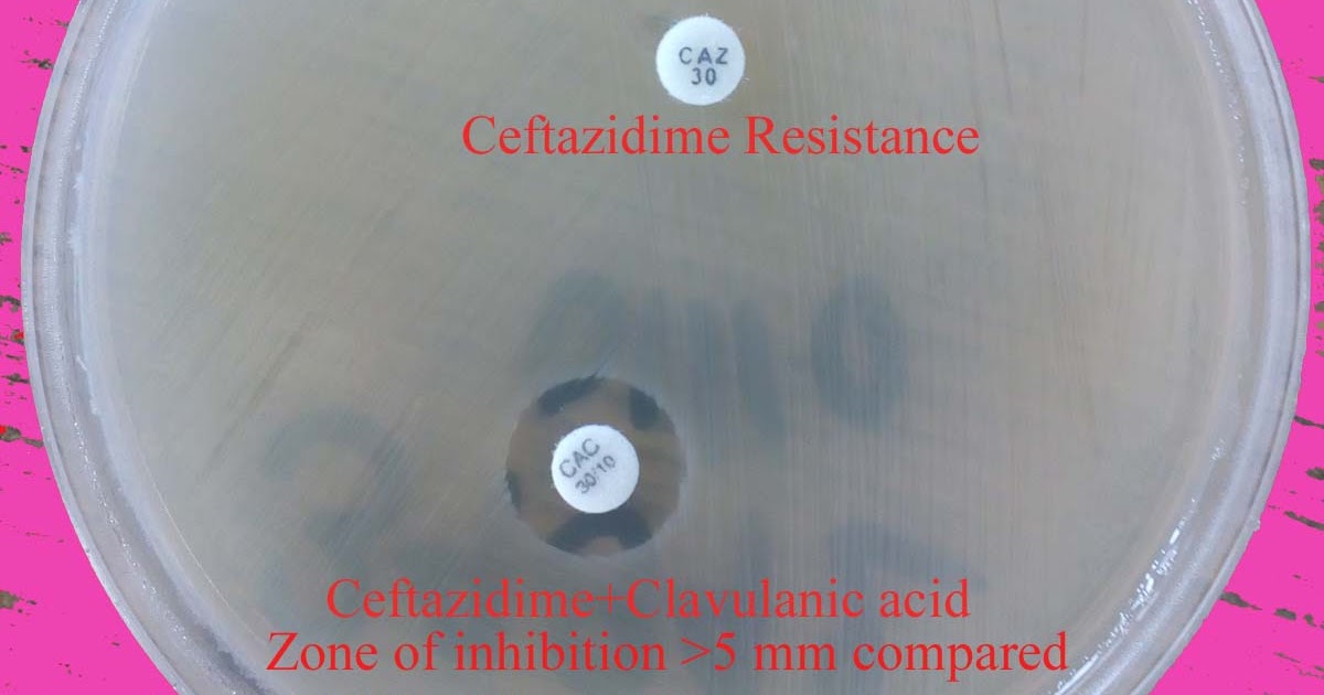MICROBIOLOGY BLOG FOR STUDENTS (MBLOGSTU): Extended Spectrum β ...