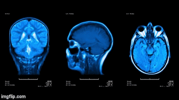 SNEAK PEEK : "The Female Brain"