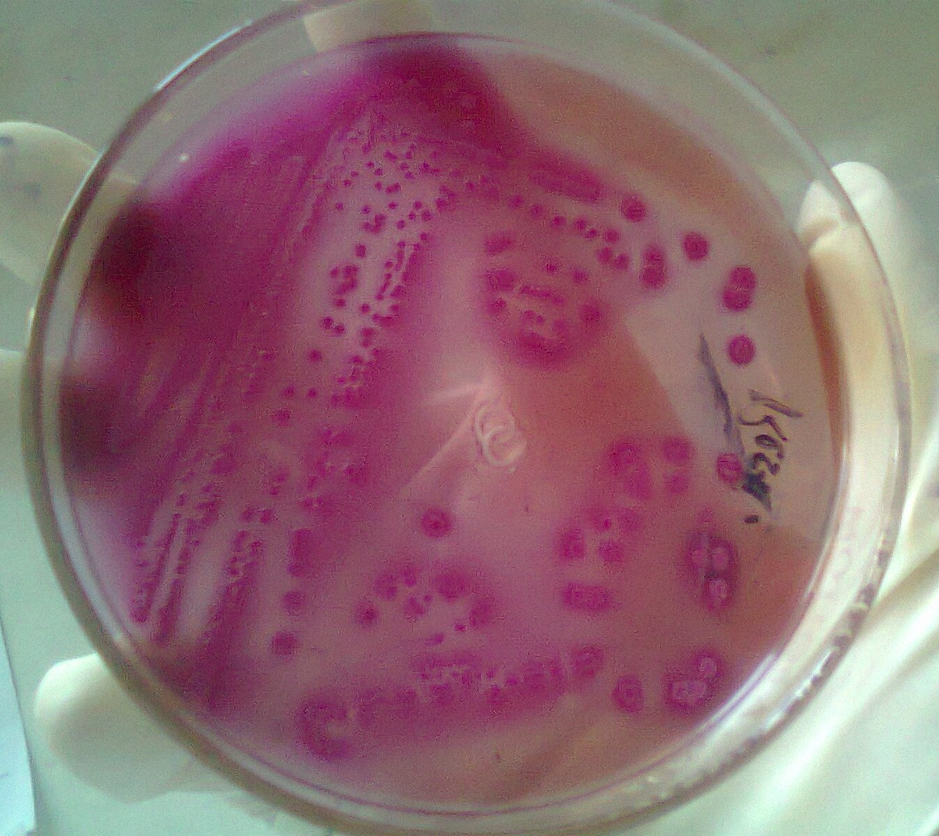 Kultur dan Hasil Uji Biokimia Bakteri Gram Negatif ~ Analis Kesehatan ...