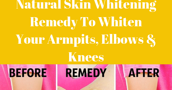 Natural Skin Whitening Remedy To Whiten Your Armpits, Elbows & Knees ...