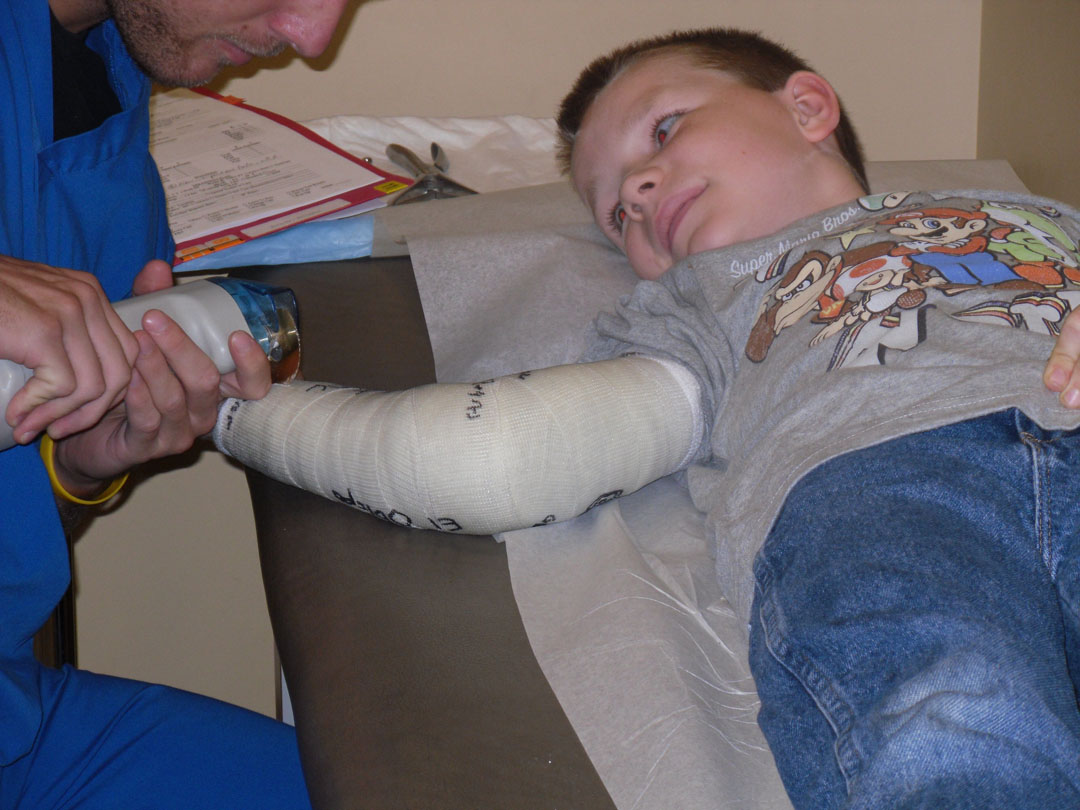 The Adventures of Ben and Nathan!: Ben getting his cast off