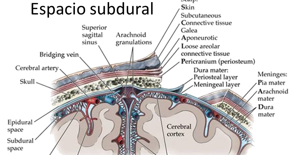 El Blog de Isa y Juan: Hematoma subdural