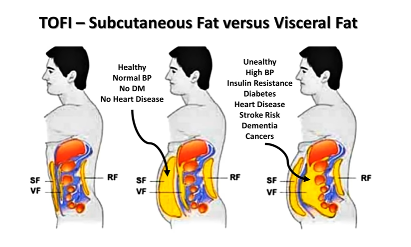 RDO: Dr Nadir Ali - Personal Fat Threshold