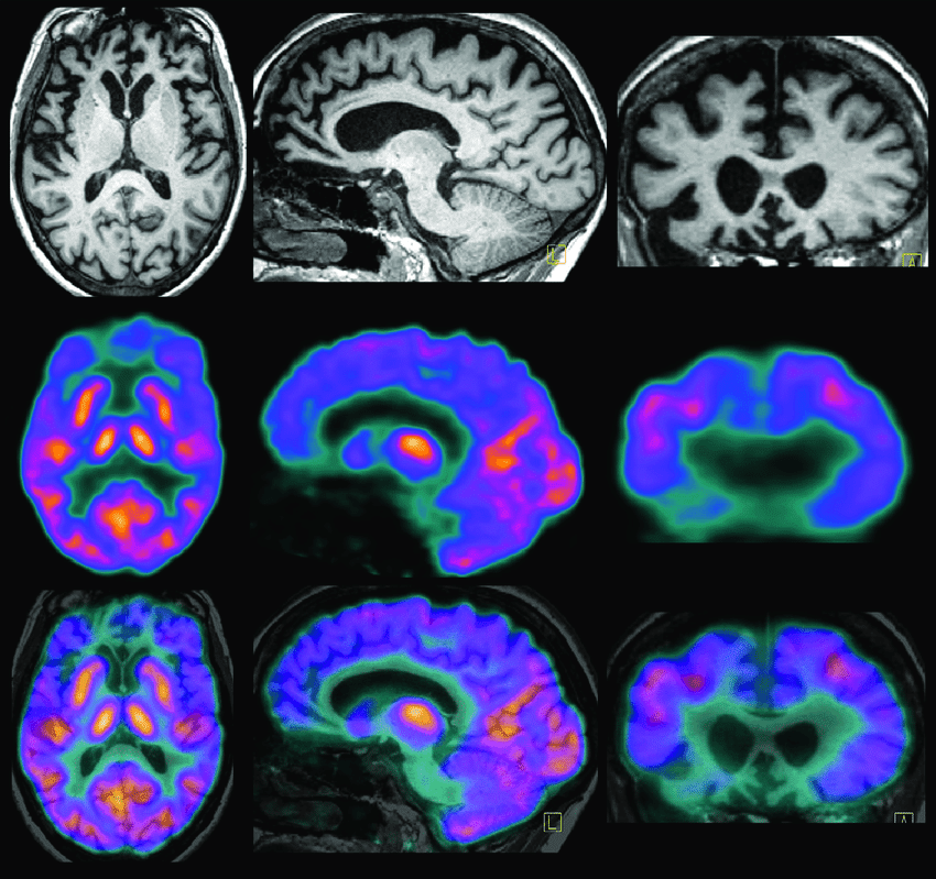 Central Clinical School News Blog: Participants sought: Treatment for ...