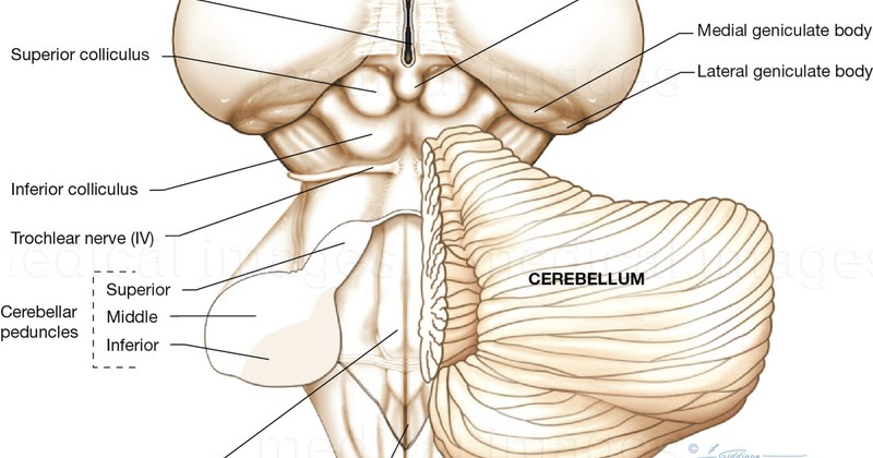 Neurosurgery - Telovelar approach