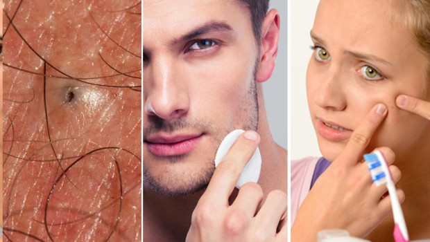 UKLONITE MITISERE UPOTPUNOSTI ZA SAMO 10 MINUTA! ~ KOLAČIĆI