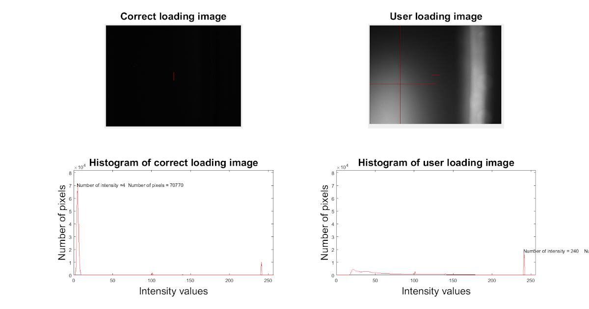 Biomedical Signal and Image Processing projects using Matlab and ...