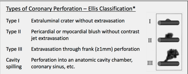 HealthforHeart: Management of percutaneous coronary intervention ...