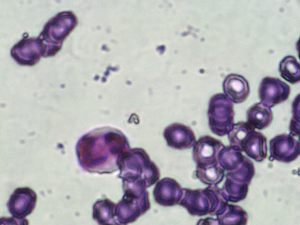 Nadi_Biologi: Bentuk-Bentuk Leukosit (Pengamatan Apus Darah)