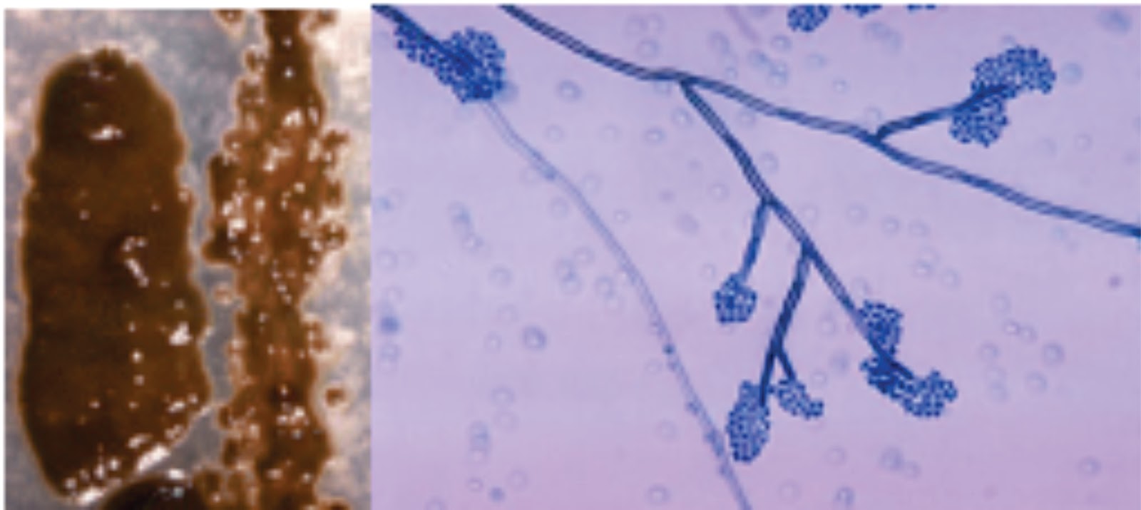 Penyakit Fungal (Jamur) Pada Ikan : Exophiala sp - Lalaukan