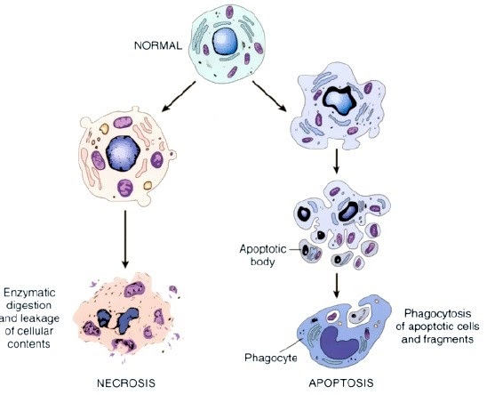 Perbedaan Nekrosis dan Apoptosis ~ Langit Kehidupan