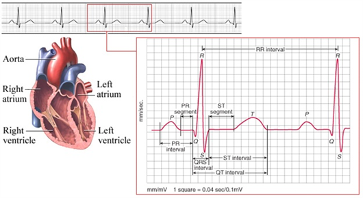 ECG (Electro cardio gram)
