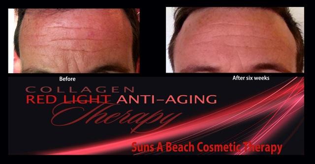 Today @ The Beach: Collagen Red Light