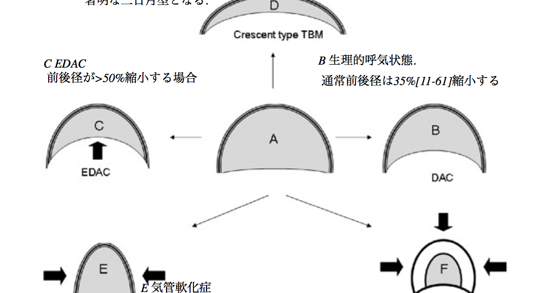 Hospitalist ~なんでも無い科医の勉強ノート~: 気管軟化症, EDAC 再掲