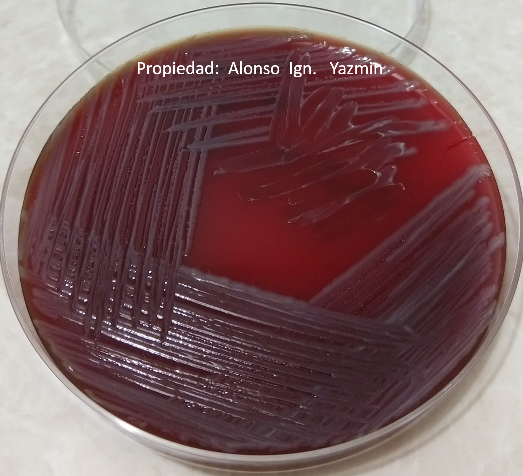 Xld Agar Yersinia Entercolitica