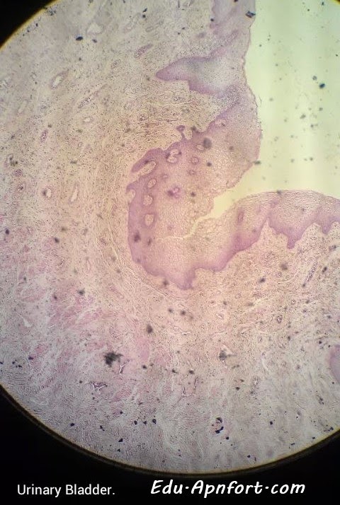 Educational Blog : Urinary Bladder slides