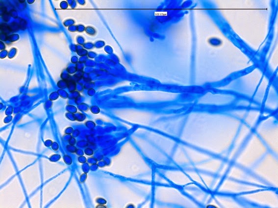 Fun With Microbiology (What's Buggin' You?): Scopulariopsis brumptii