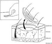 Dentistry and Medicine: Principles and Techniques of Biopsy