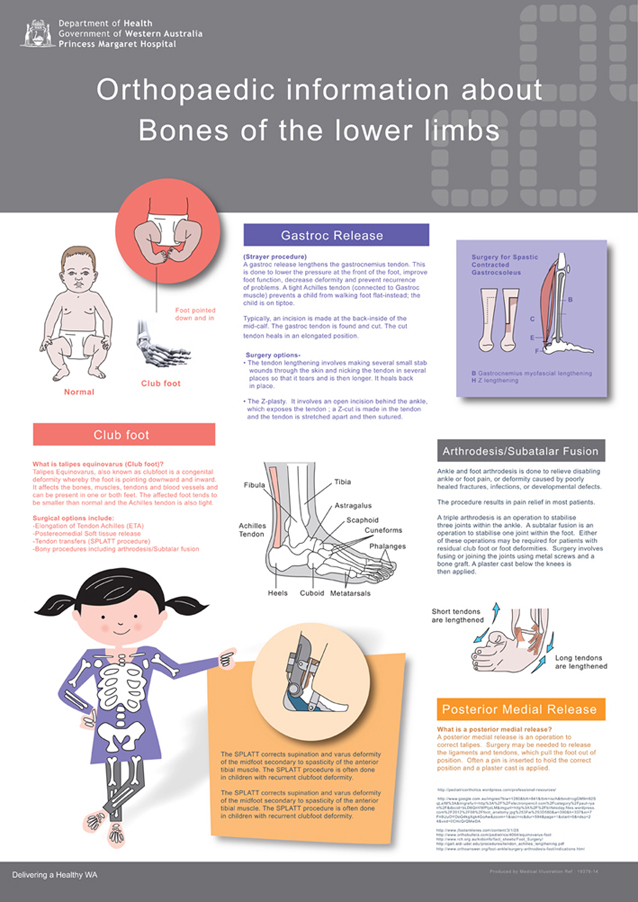 esani: Medical poster for Children.