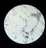 Struktur Jamur Oncom - Perumperindo.co.id