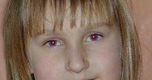 Red Eye Correction from an Image using OpenCV