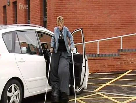 Mandy Sellars - The Woman with Giant Legs | Most Unbelievable & Amazing ...