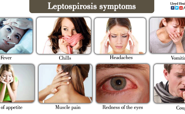 Leptospirosis Rare Disease Spreads in New York City – Healthy plus