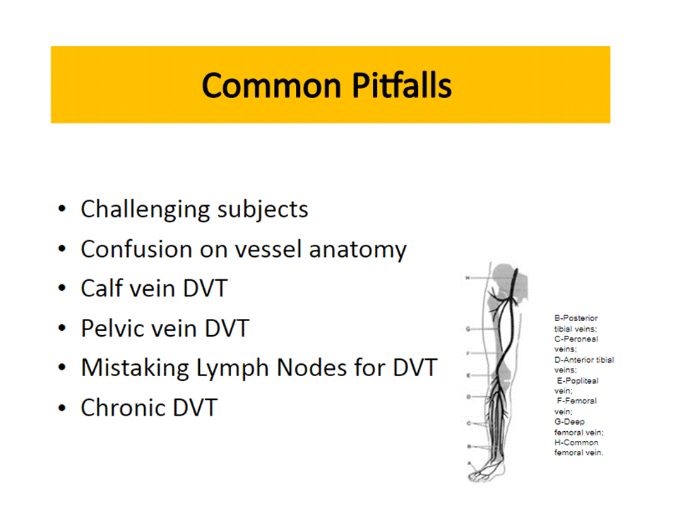 BÀI SOẠN VỀ SIÊU ÂM CHẨN ĐOÁN: Acute and Chronic DVT and Ultrasound (US)