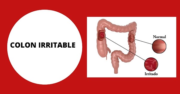 Colon Irritable - Colon inflamado Nutricionista Ecuatoriano