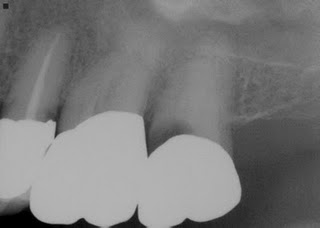 The Daily Grind: Decay Under Crowns