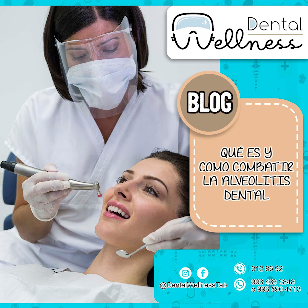 ALVEOLITIS DENTAL