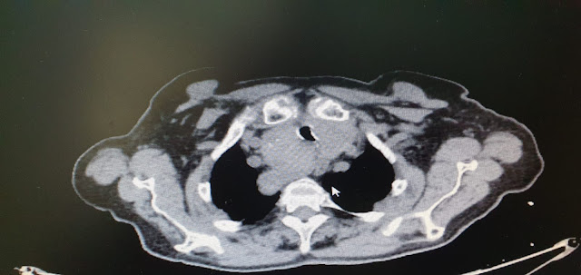 EL RINCÓN DE LA MEDICINA INTERNA. juanpedromacaluso@yahoo.com.ar: MUJER ...