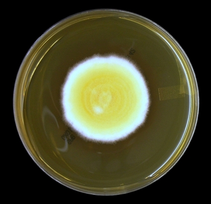 Fun With Microbiology (What's Buggin' You?): Blastomyces dermatitidis