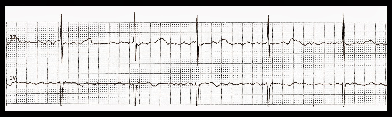 Practice EKG Strips 373