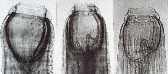TRICHURIS-TRICHURIS