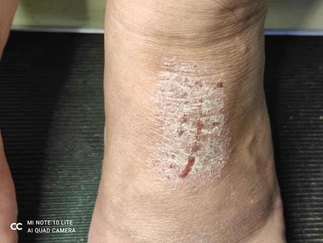 EL RINCÓN DE LA MEDICINA INTERNA. juanpedromacaluso@yahoo.com.ar: MUJER ...