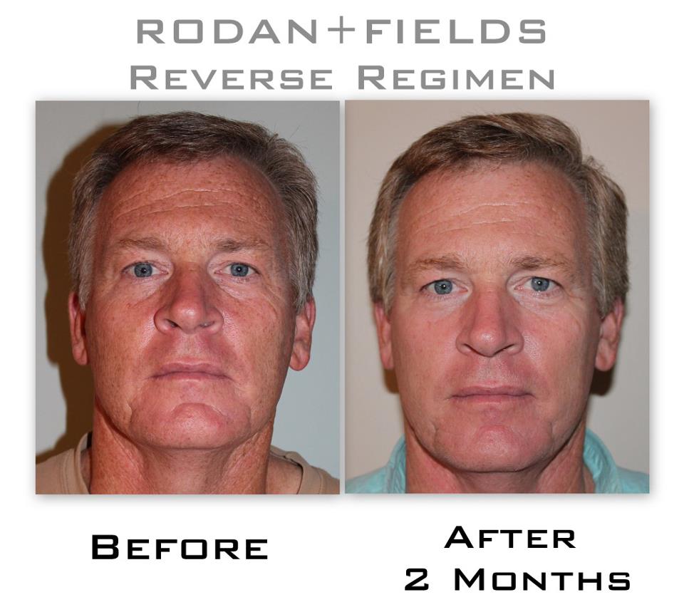 More for Four: Your Skin + the Sun - the good, bad, and UGLY!